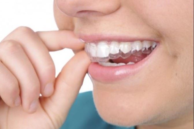Prevent Dental Problems With Invisalign